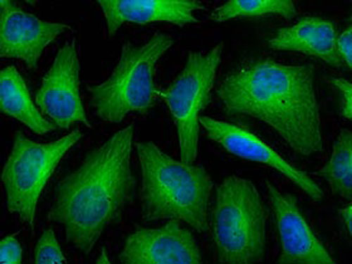 Ten Tips to Light Up Your Immunofluorescence Experiments | Bio-Rad